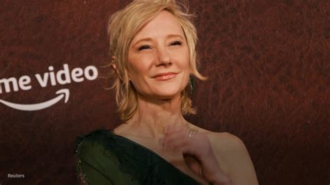 Anne Heche In Coma After Car Crash Rep Says She Is In Extreme