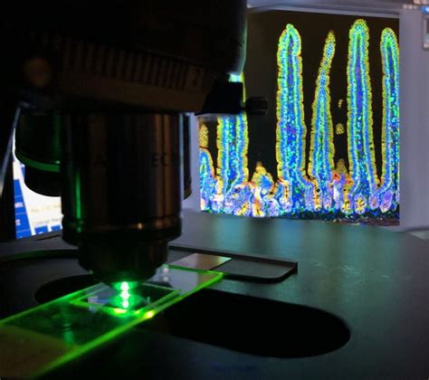 Fluorescence Microscopy Molecular Microbiology Imaging Facility Washington University In St