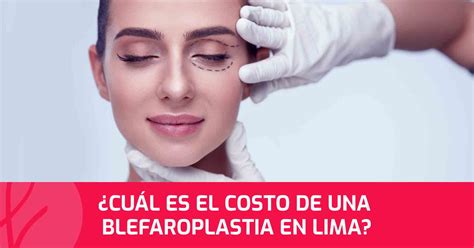 Dr Edwin Vásquez Entre Los Mejores Cirujanos Plásticos De Perú Dr