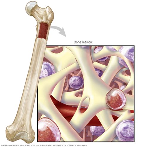 Aplastic Anemia Disease Reference Guide