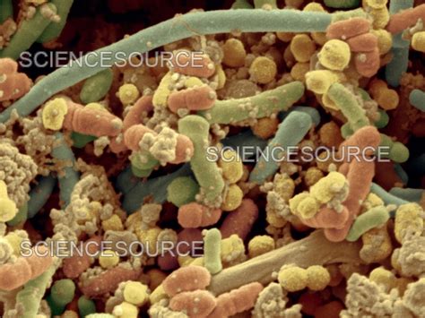 Streptococcus Pyogenes Stock Image Science Source Images
