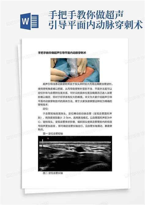 手把手教你做超声引导平面内动脉穿刺术Word模板下载 编号qjnjranw 熊猫办公