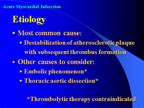 Cardio 28 Acute St Elevation Mi Flashcards Quizlet