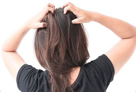 Dry Scalp Causes Symptoms And Treatment Emedihealth