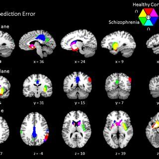 Negative Prediction Error In Three Groups Negative Correlates Of Download Scientific Diagram