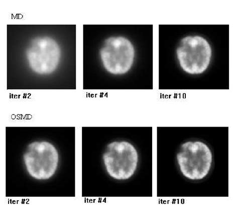 Brain Near Mid Slice Of The Reconstructions Download Scientific