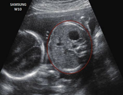 C Fig 7 Examples Of Classification Detection Segmentation And Download Scientific Diagram