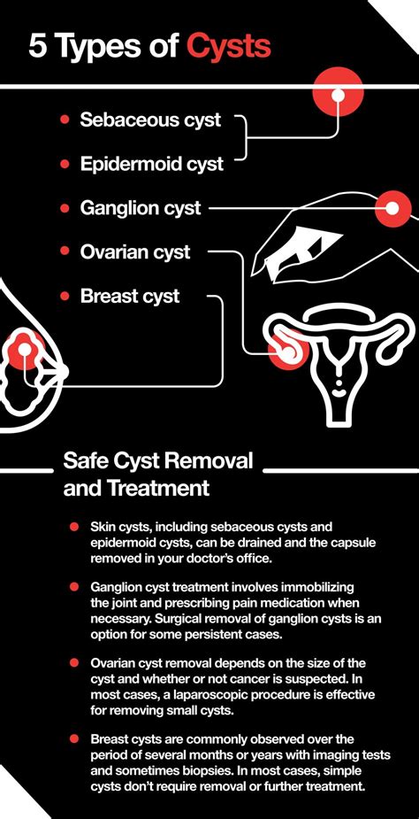 Sebaceous Cyst Diagram