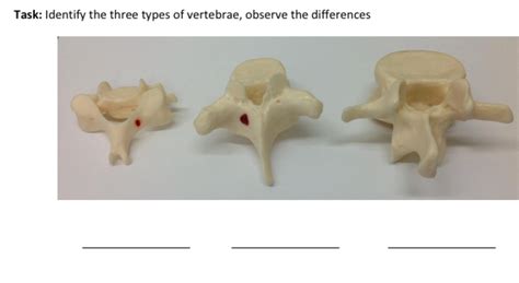 Task Identify The Three Types Of Vertebrae Observe The Differences
