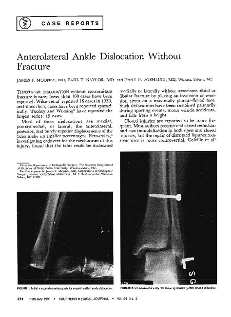 Pdf Anterolateral Ankle Dislocation Without Fracture