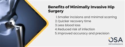 Minimally Invasive Hip Surgery Orthopaedic Surgery Associates In Boca