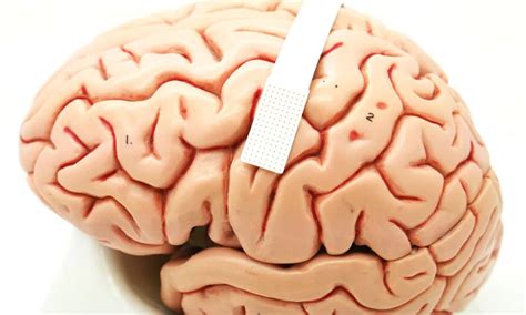 A Speech Prosthetic Translates A Persons Brain Signals Into Speech