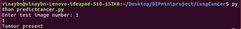 Github Vinaybn8997lungcancerdetectionusingpython Lung Cancer