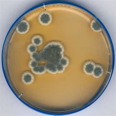 Sabouraud Dextrose Agar Vingmed