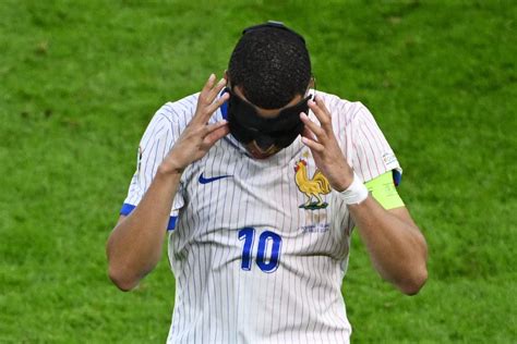 La Nariz De Mbappé Analizada Por Un Cirujano Maxilofacial “cuando Se