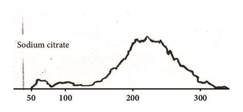 Wbc Histograms Of A Sample Drawn Six Days After Admission A Left Peak