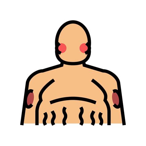 Cushing Disease Endocrinology Color Icon Vector Illustration 10386110 Vector Art At Vecteezy