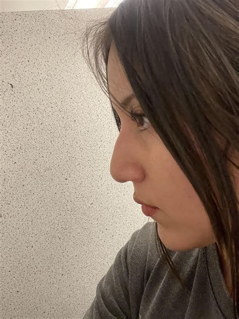 Ive Always Been Insecure About My Nose Does It Suit My Face Or Should