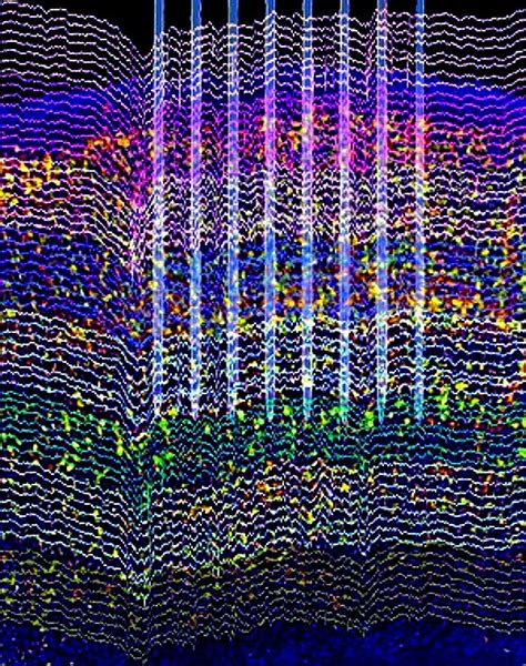 Brain Pacemaker Detects Seizures And Treats Epilepsy In Rats