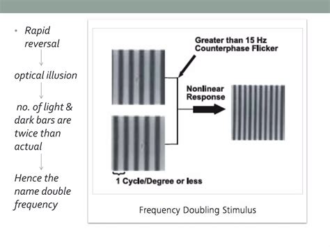Diagnosis Of Pre Perimetric Glaucoma Pptx