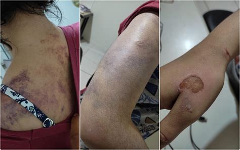 Mecânico é preso suspeito de espancar a mulher por 6 horas e colocar
