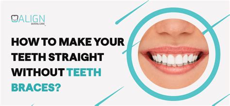 5 Simple Ways To Straighten Your Teeth Without Dental Braces