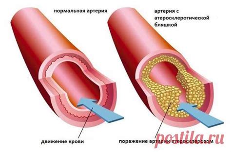 Врачи молчат об этом! Эти 8 продуктов очищают организм лучше любых лек ...