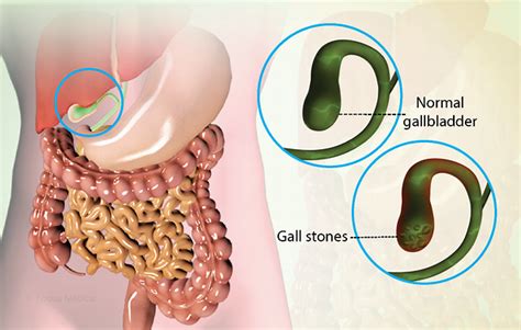 Health Condition Symptoms Causes Treatment And More