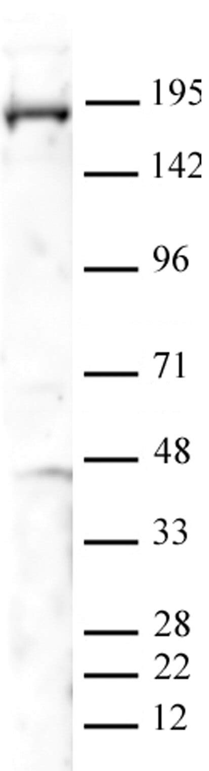 PBRM1 Antibody PAb Proteintech
