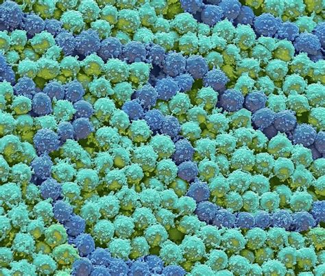 Lactococcus Bacteria Photograph By Steve Gschmeissner Science Photo Library