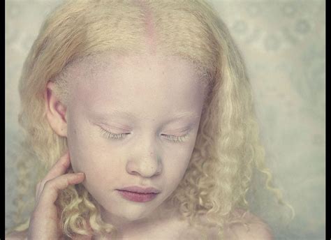 Stunning Photos Of Models With Albinism Capture The Beauty In Breaking
