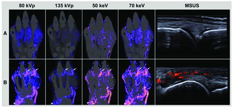 Imaging Examples Conventional Ct Subtraction For 80 And 135 Kvp Download Scientific Diagram