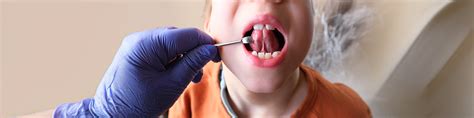 Medications Can Contribute To Dry Mouth Syndrome And Affect Your Oral
