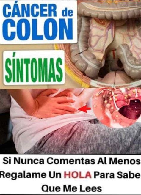 CÁncer De Colon Causas SÍntomas Y Como Prevenirlo Salud