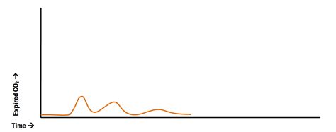 Abnormal Capnography Waveforms And Their Interpretation Deranged