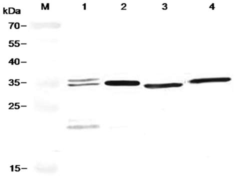 Immunoblot Of Soluble Scfv Antibodies Extracted From Periplasm In