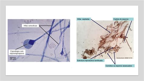 Caracteristicas Das Hifas De Aspergillus