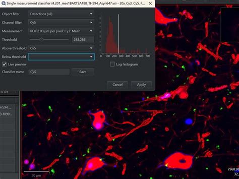 Qupath Mulitplexed Analysis On Neurons Image Analysis Image Sc Forum