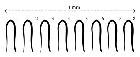 Distribution Of Capillary Per Mm A Normal Capillary Arrangement B