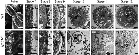 Scanning Electron Microscopy Sem And Transmission Electron Microscopy