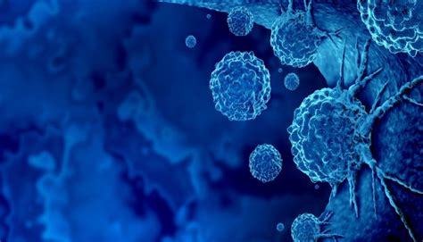 At A Glance First Line Immunotherapy For Advanced Urothelial Carcinoma