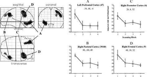 Evaluation Task Nonspatial Rule Voxels With Rcbf Decreases From 1st