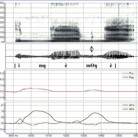 Spectrogram Audio Waveform Intraoral Pressure Po Oral Airflow