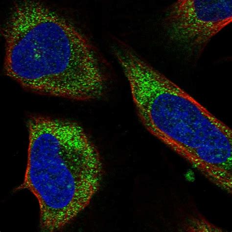 Rabbit Polyclonal Anti Ccz1 Antibody Buy For Research Highly