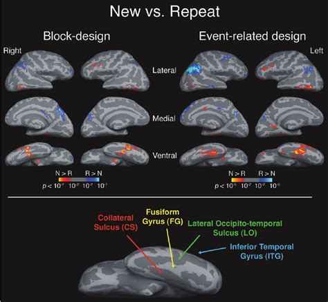 New Versus Repeat Statistical Activation Maps Illustrating The Download Scientific Diagram