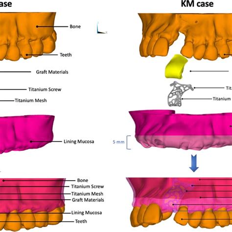 Finite Element Models Used In The Present Study Both Two Models