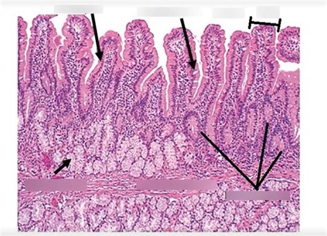 Duodenum Histology Labelled Diagram Quizlet