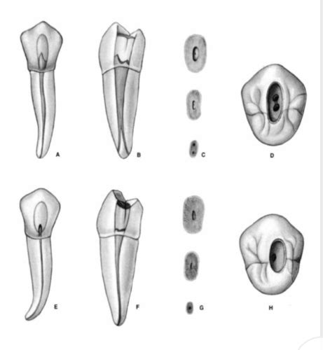 Mandibular Second Premolar Flashcards Quizlet