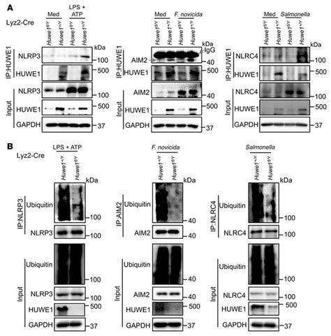 jci huwe1 mediates inflammasome activation and promotes host defense