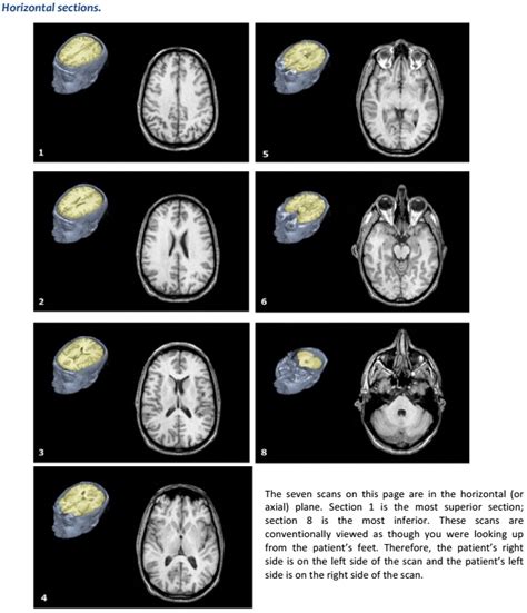 Duke Neurosciences Lab 5 Forebrain Sectional Anatomy